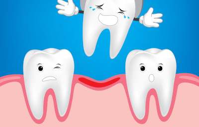 Causes and Prevention of Tooth Loss - My Dentist Burbank