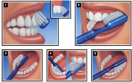 Taking Care of Your Teeth and Mouth - My Dentist Burbank