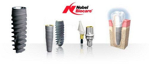 Dental Implant Materials and Companies in Burbank - My Dentist Burbank