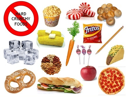 How to Avoid Dry Socket After Tooth Extraction - My Dentist Burbank