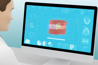 dental monitoring - My Dentist Burbank