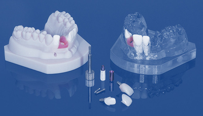 How Does My Dentist Take a Digital Impression? - My Dentist Burbank